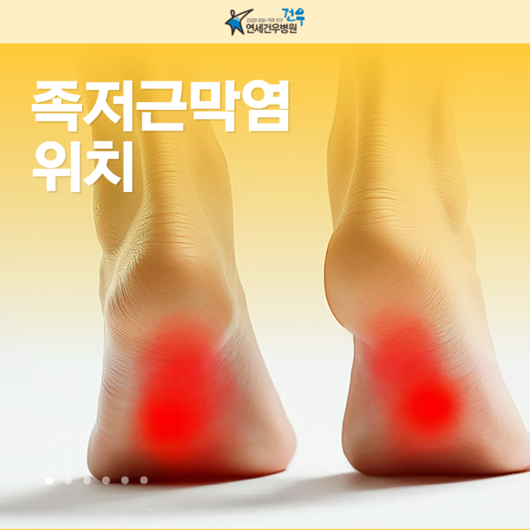 평발과 족저근막염 위치에 따른 통증 및 증상 : 네이버 블로그