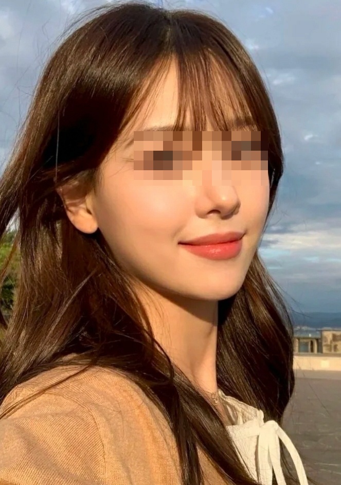 W클리닉 삼성점 의원 써마지FLX 600샷 받고 젊게 살아본 후기 : 네이버 블로그