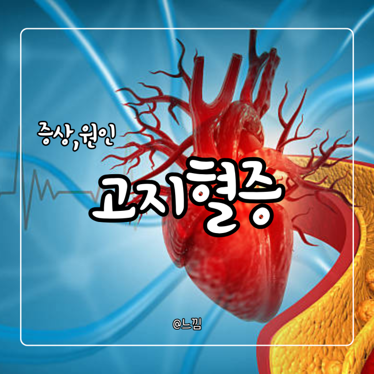 고지혈증 증상 및 수치 원인 고지혈증 좋은음식, 약 : 네이버 블로그