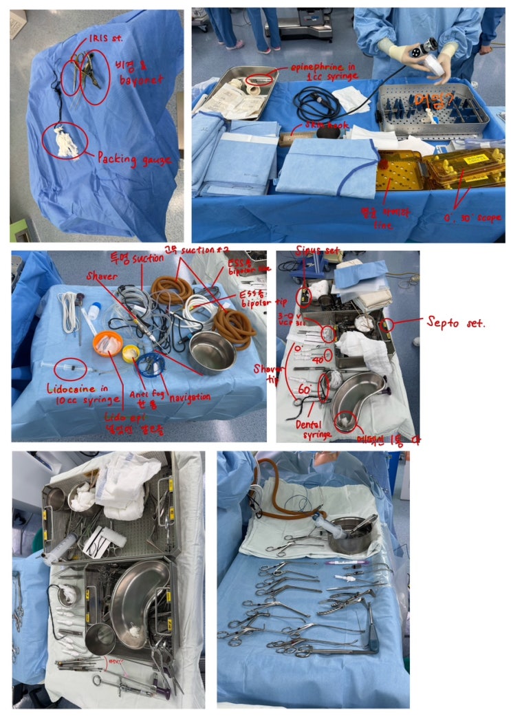 ESS(Endoscopic Sinus Surgery) & Navigation : 네이버 블로그