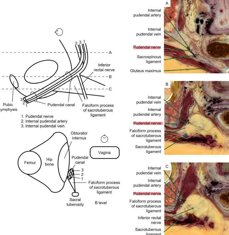 Alcock's canal & Pudendal nerve : 네이버 블로그