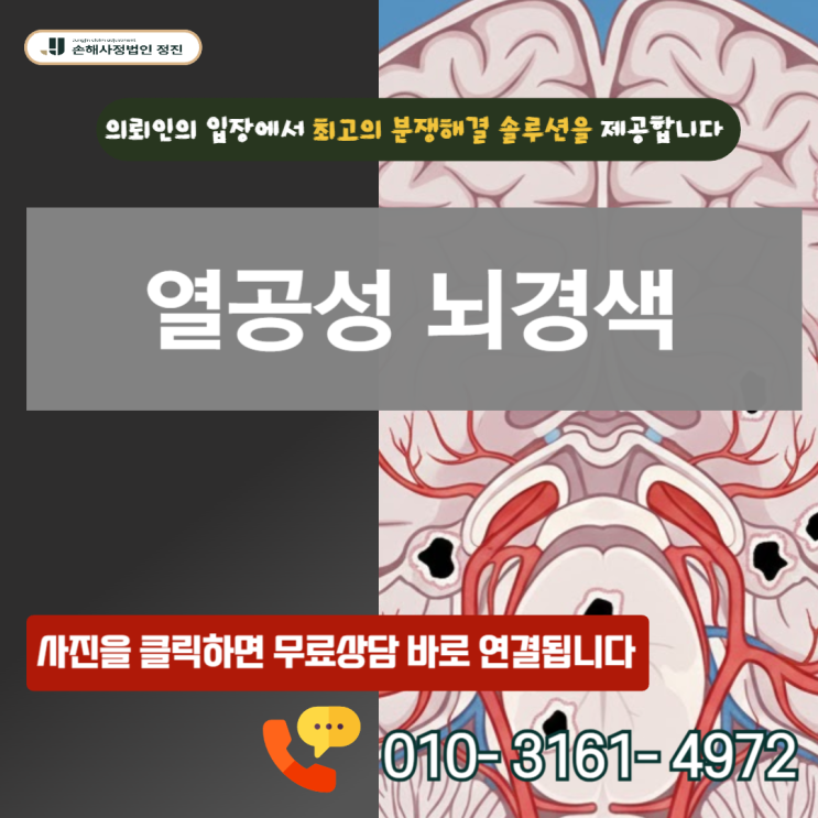 열공성 뇌경색 I63.9, 증상 없어도 뇌졸중 진단비 받는 법 : 네이버 블로그