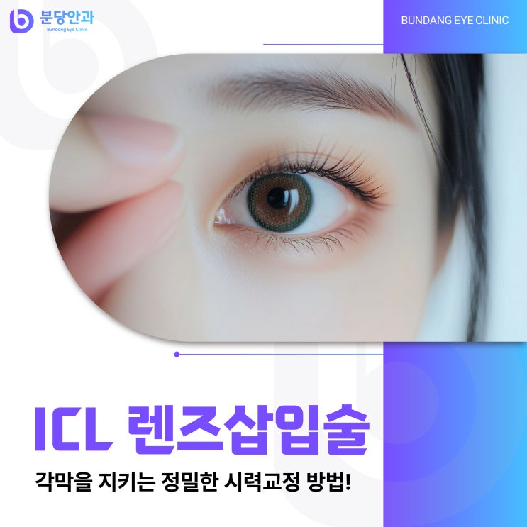 판교 분당안과, 각막을 보존하는 시력교정법 ‘ICL 렌즈삽입술’ : 네이버 블로그