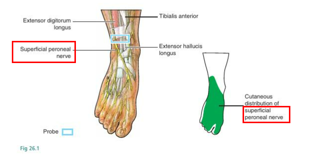 발등이 저리고, 타는 듯 화끈거려요. : 천비골신경포획증후군(Superficial Peroneal Nerve Entrapment ...