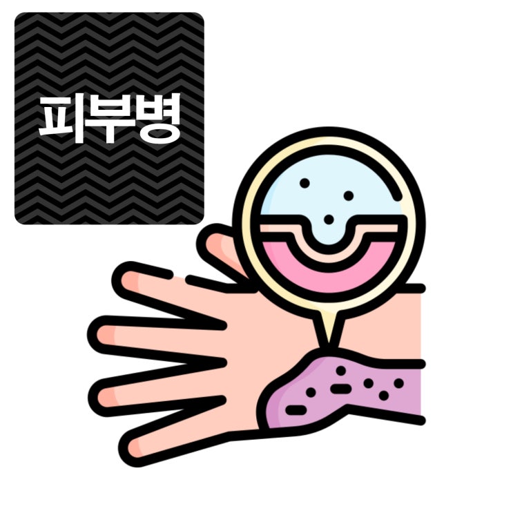 가장흔한 피부병 : 네이버 블로그