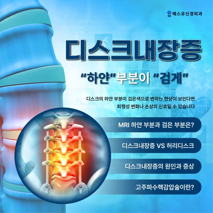 디스크MRI 하얀 부분이 검게 변하는 디스크내장증 : 네이버 블로그