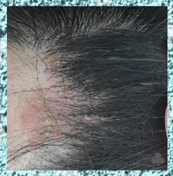 클로란 드라이 피오니 샴푸 써본 솔직후기 : 네이버 블로그