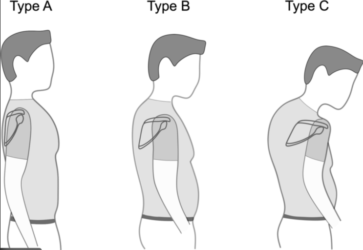 라운드숄더(Rounded shoulder posture) 임상 해부학으로 심층분석 : 네이버 블로그