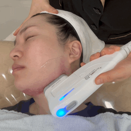 울산동구피부관리 울산에스테틱 에스떼청담 메디리프팅 후기 : 네이버 블로그