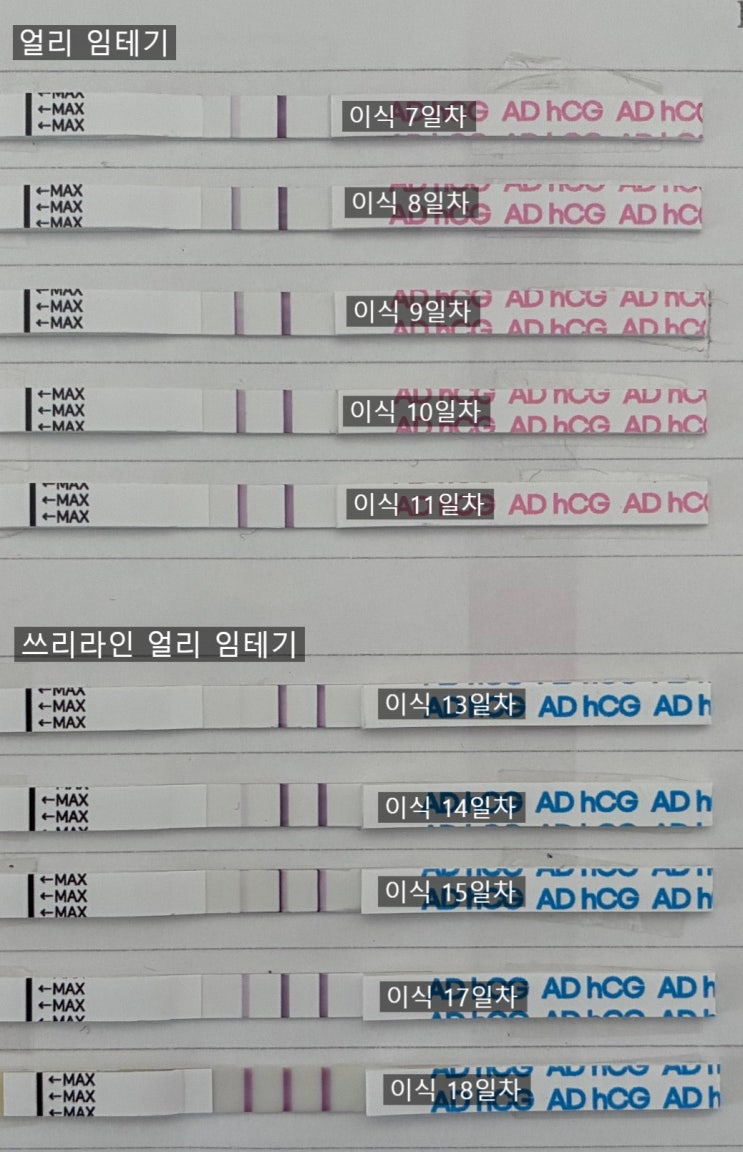 [난임일기/시험관 3차] 5일 배아 21일차 쓰리라인 역전 | 난황 확인 | 심장소리 확인🍀| 국민행복카드(롯데) 사용방법 ...
