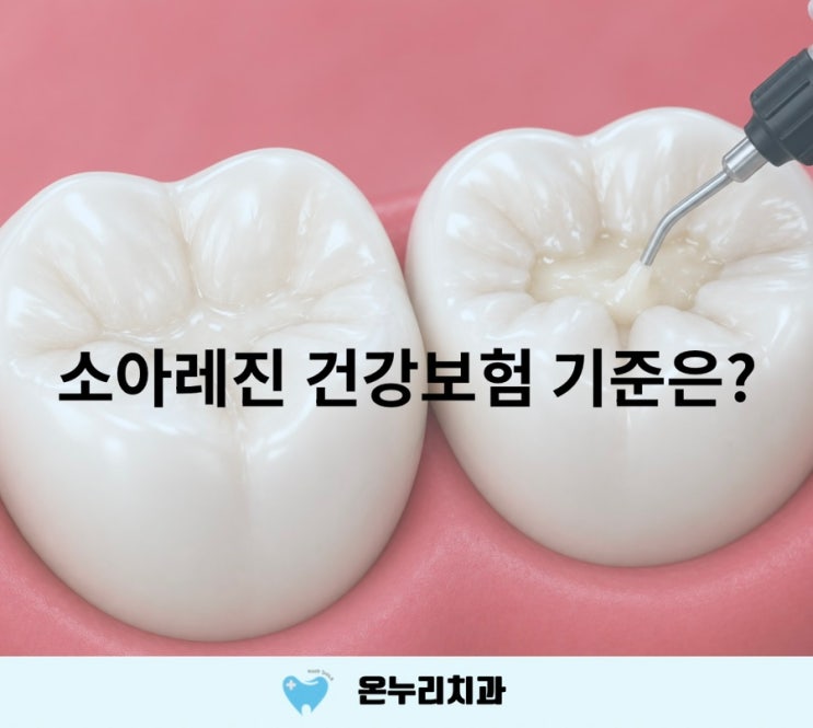 [다대포치과] 만 12세 이하 어린이 충치, 레진치료 건강보험 혜택 꼭 챙기세요! : 네이버 블로그