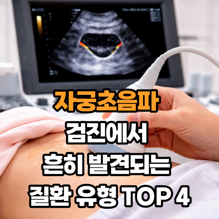 자궁초음파 검진에서 흔히 발견되는 질환 유형 TOP 4 : 네이버 블로그
