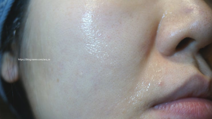 [리쥬치올 PDRN 퍼펙트크림] 강력한 보습으로 은은한 광채, 약국에서 판매되고 있는 약국화장품 PDRN크림 사용후기 : 네이버 블로그