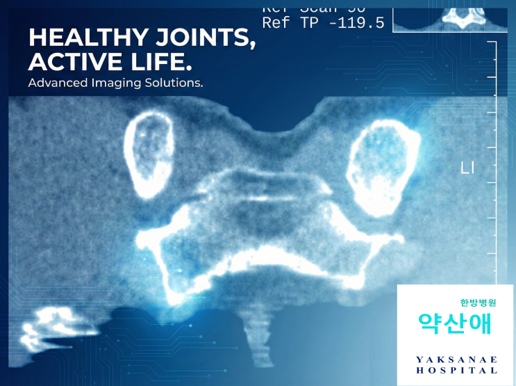 AC joint(견봉쇄골관절) - 약산애 한방병원 : 네이버 블로그