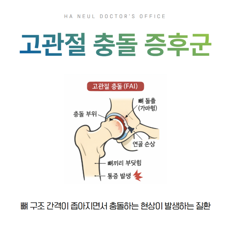 한쪽 골반 찝힘 앉을 때 불편한 감각과 통증이 느껴질 경우 : 네이버 블로그