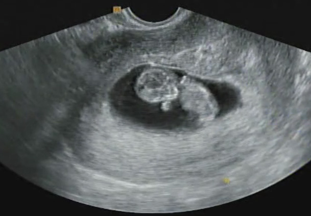 착상잘되는음식 있나요? : 네이버 블로그