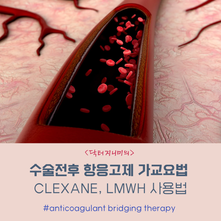 항응고제 투여 받는 환자, 수술 전후 anticoagulant bridging therapy(가교 요법, LMWH ...