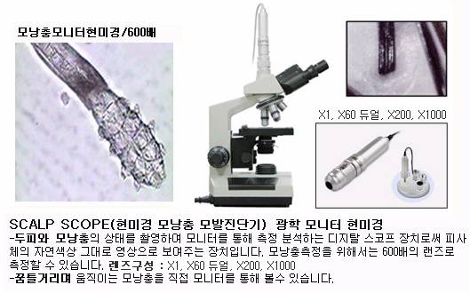 SCALP SCOPE[모낭충모발진단현미경]모발진단현미경 : 네이버 블로그