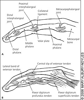 Mallet finger, Boutonnière finger : 네이버 블로그
