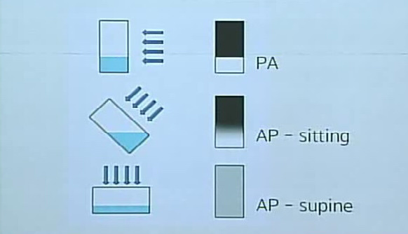 Radiologic Orders : 네이버 블로그