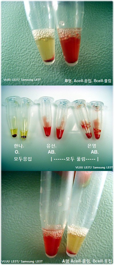 ABO typing Tube법 : 네이버 블로그